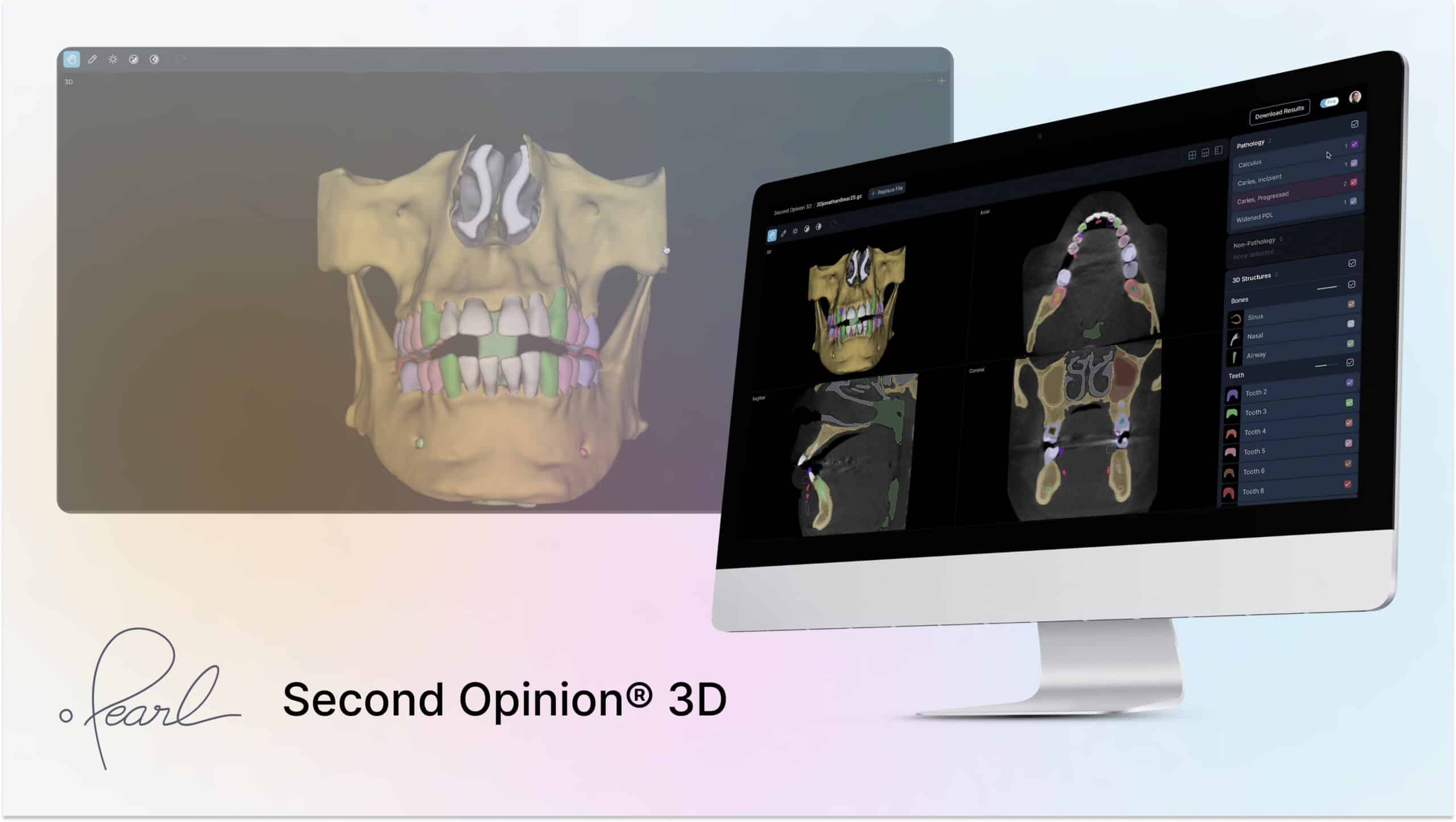Pearl Becomes First with FDA-Cleared AI for 2D and 3D Imaging
