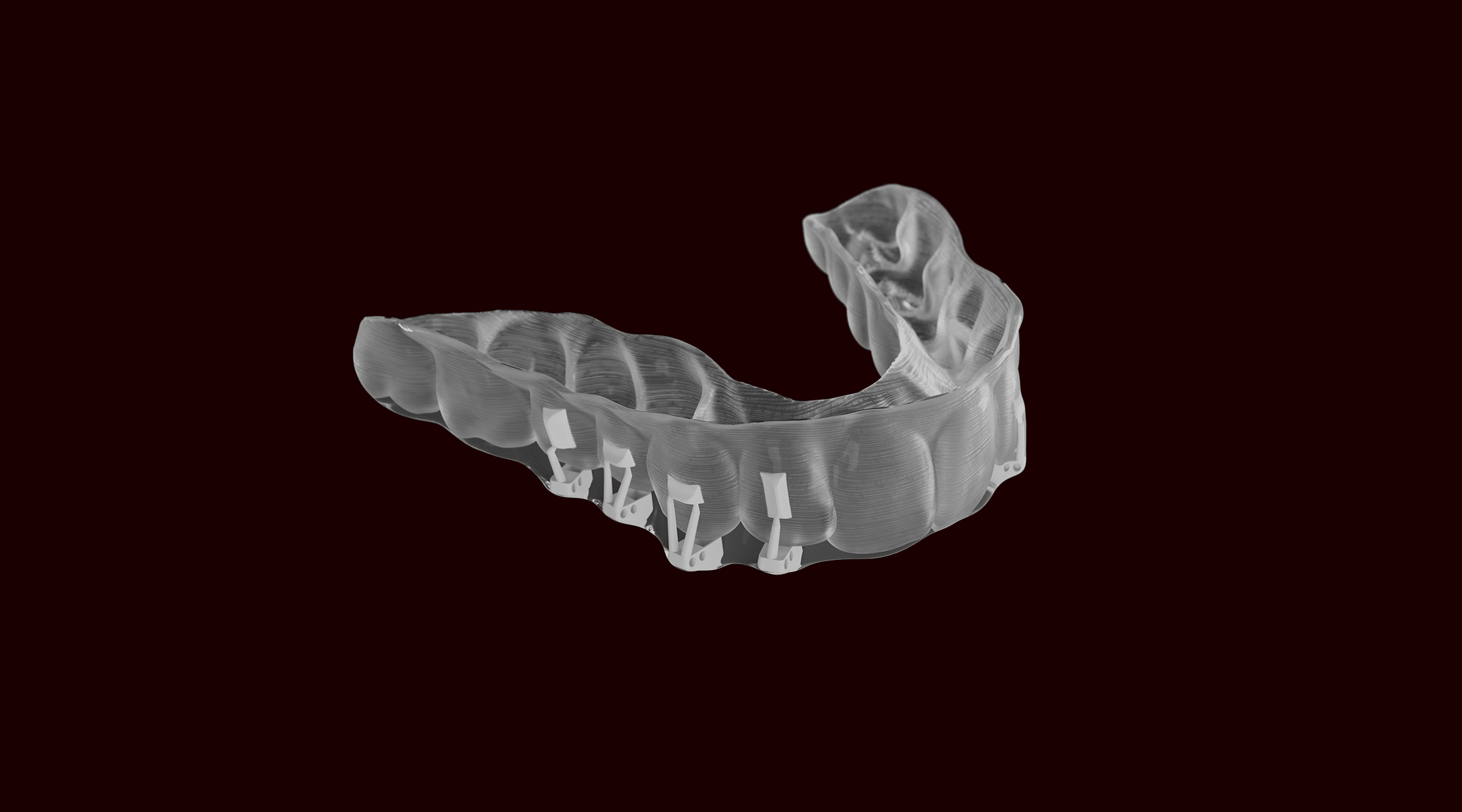 Solventum Expands Digital Orthodontic Workflow After 3M Spin-Off