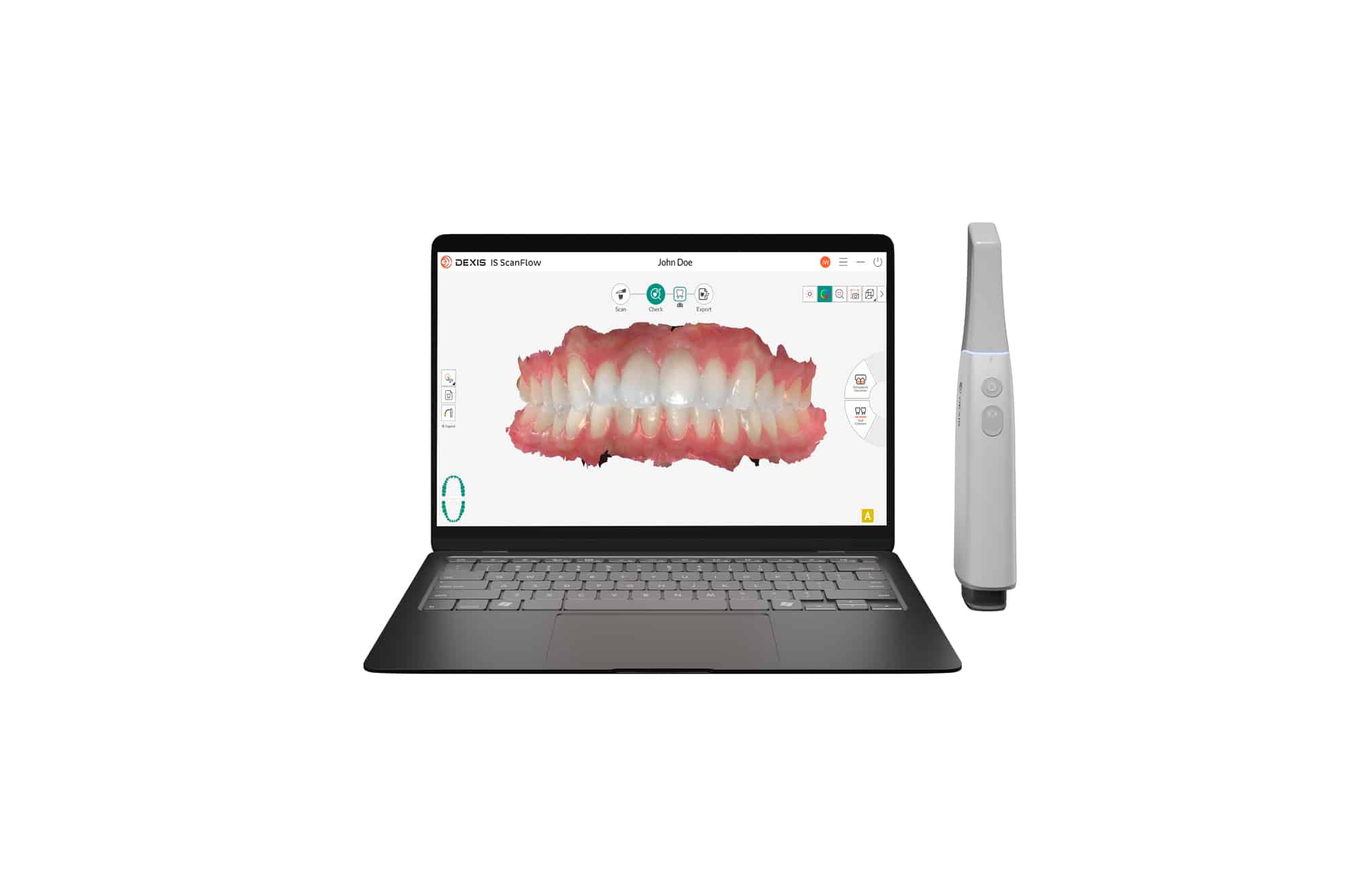 DEXIS Adds New Intraoral Scanner to Imaging Portfolio
