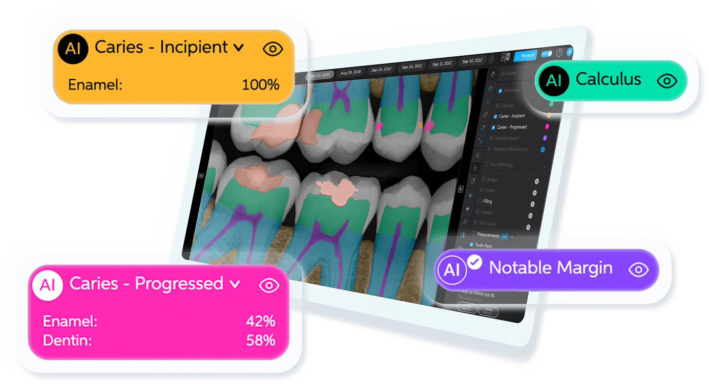 Dentsply Sirona Adds Pearl AI to DS Core for X-ray Support