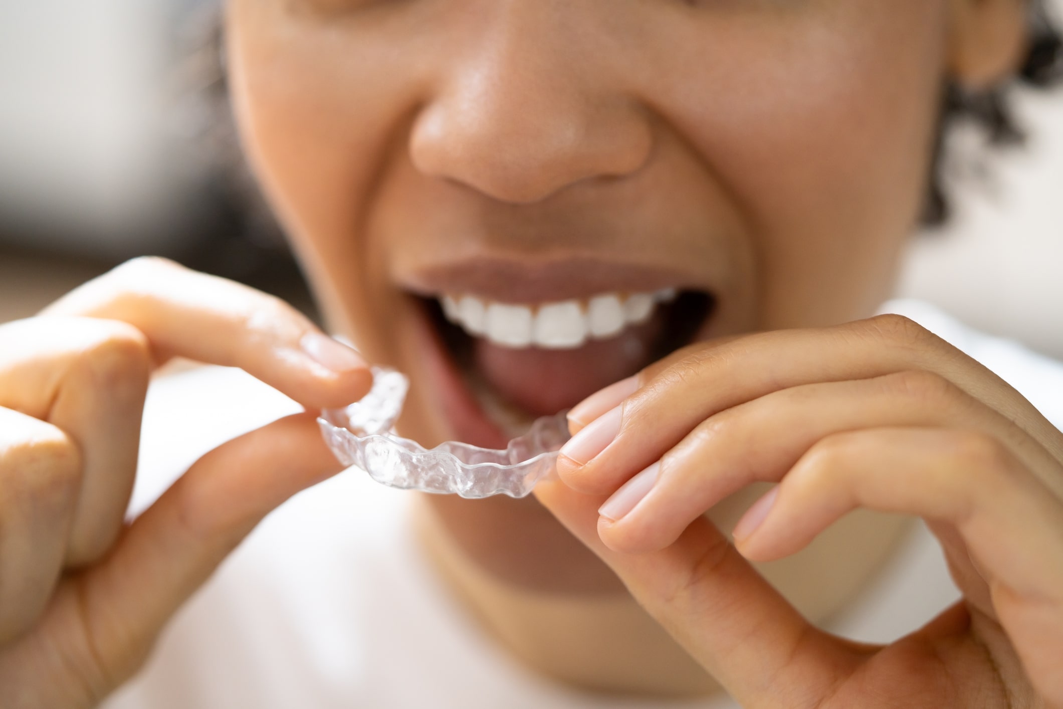 Medit Orthodontic Suite Adds Aligner Workflow