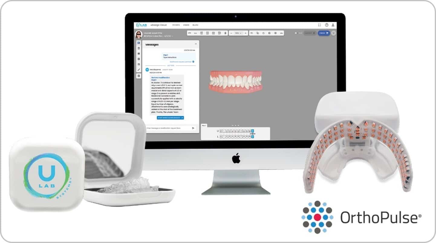 uSmile Aligners Now Available with OrthoPulse Integration