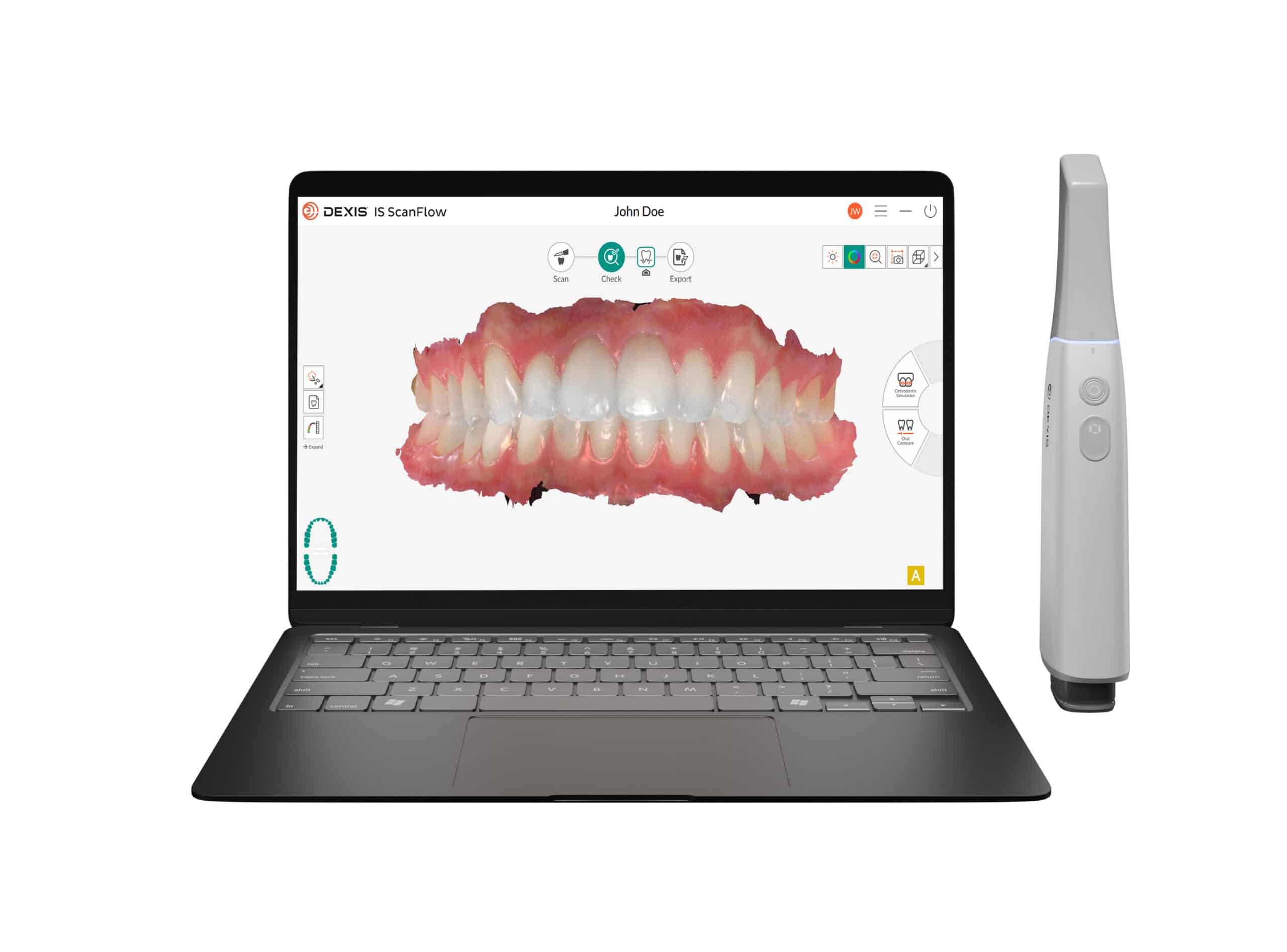 DEXIS Launches Wireless Imprevo Intraoral Scanner