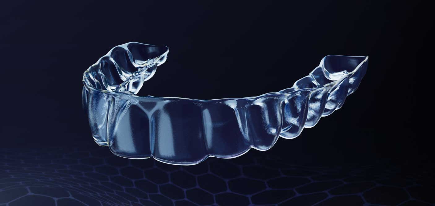 How OrthoFX PrecisionFinish Aligners Enhance Treatment Ends
