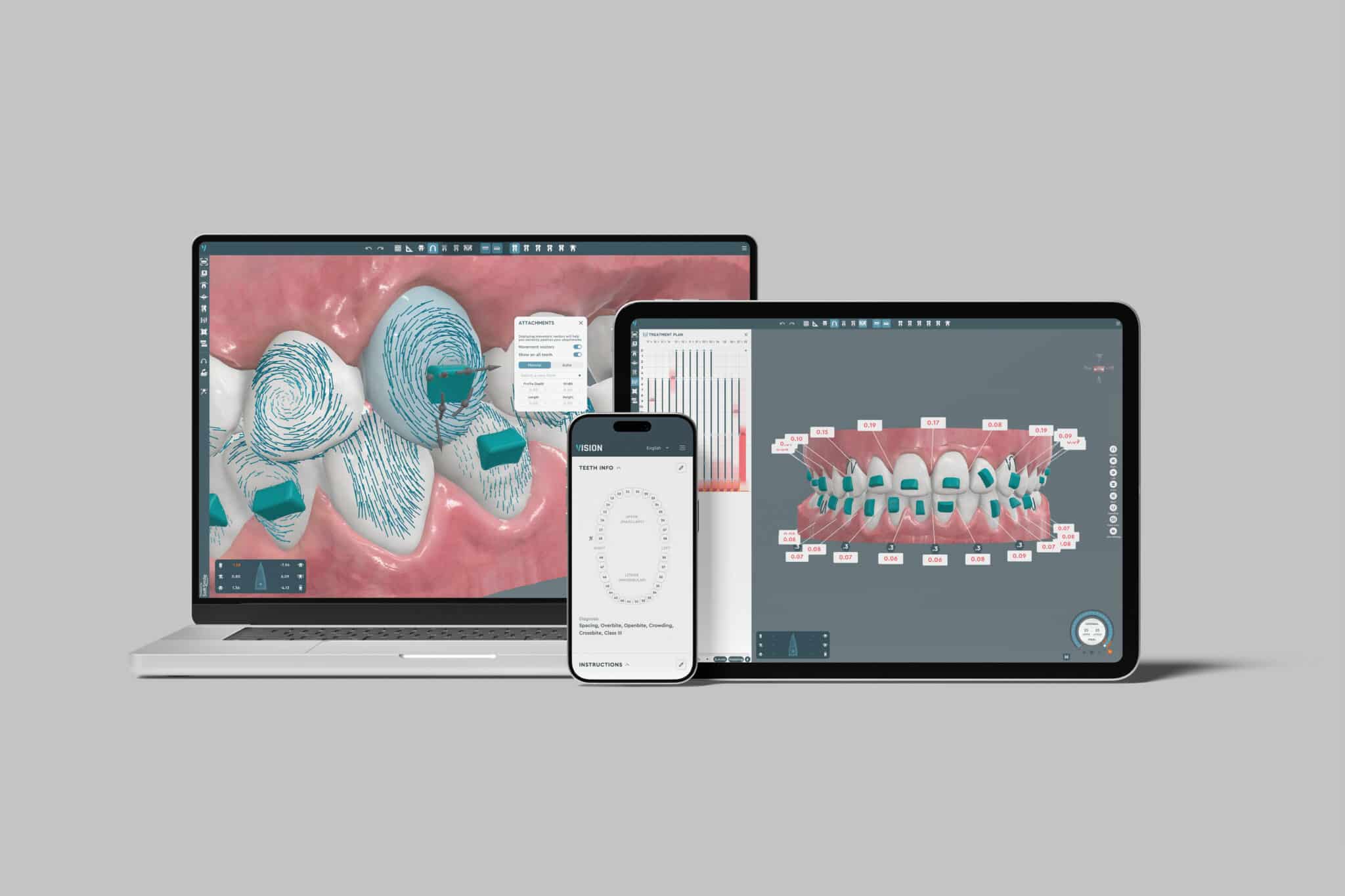 Inside SoftSmile: Improving Aligner Economics and Workflows